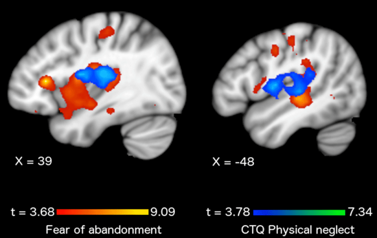 Wellcome Open Research Blog